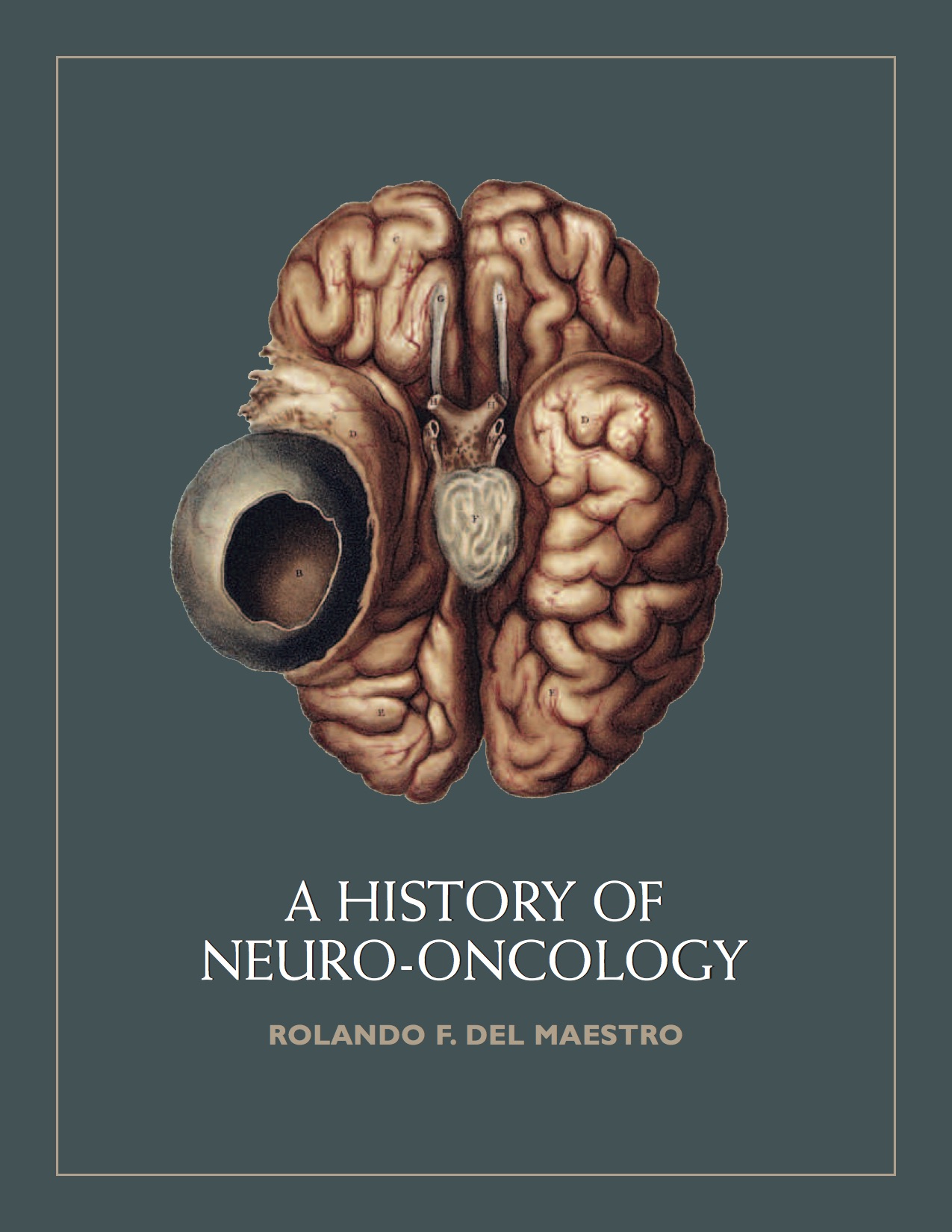 Dr. Rolando Del Maestro – NeuroSim